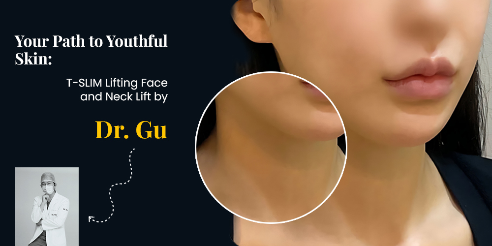 Your Path to Youthful Skin: T-SLIM Lifting Non-Surgical Face Lift and – DR GU